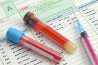 Decoding Your Pet’s Blood Work - Scripps Ranch Veterinary Hospital